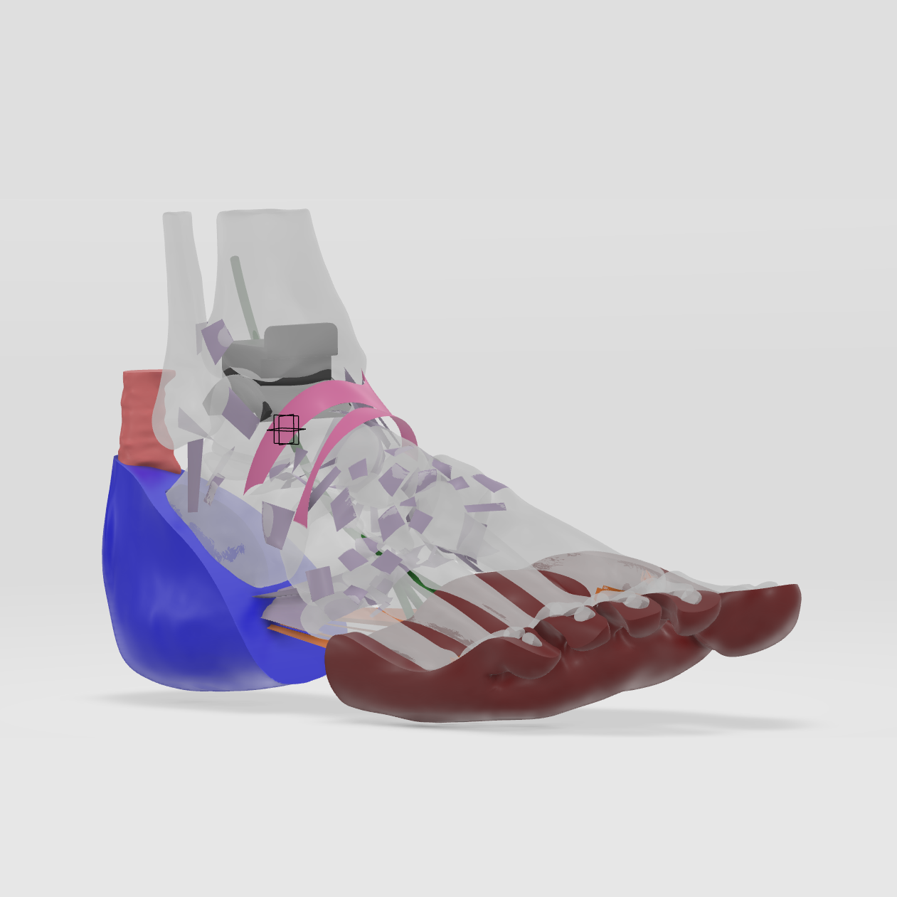 Digital Orthopaedics introduced their new platform 3DOXpert